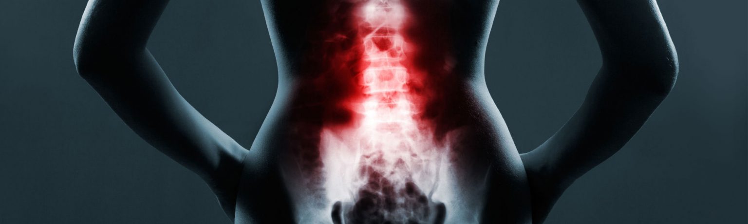 Discogenic Pain – Colorado Interventional Health Sciences